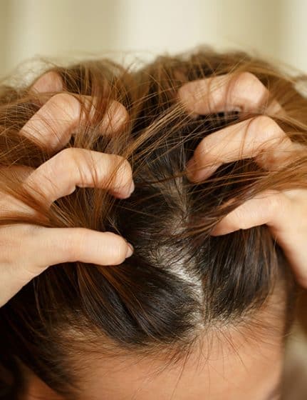 Démangeaison cuir chevelu, eczéma, psoriasis📍 Solutions efficaces