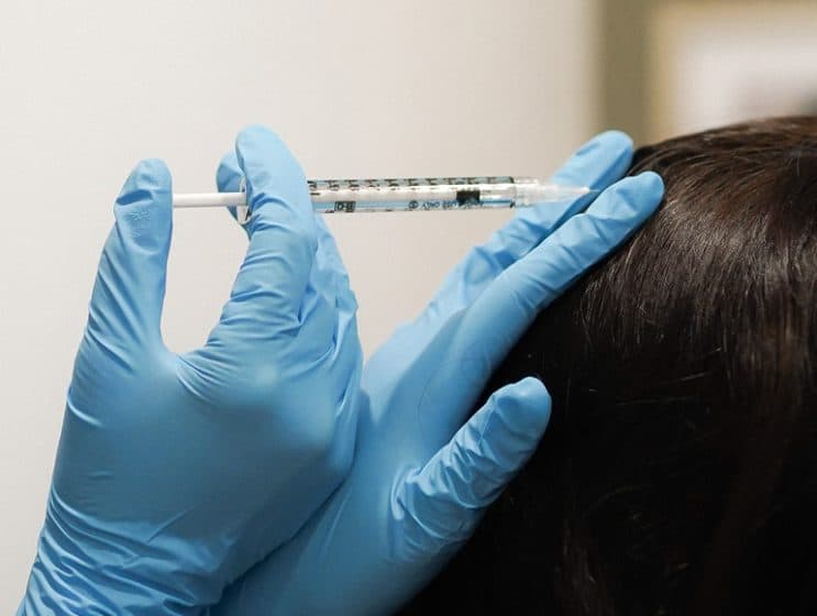 PRP cheveux: traitement efficace pour la perte capillaire, Rive-Nord